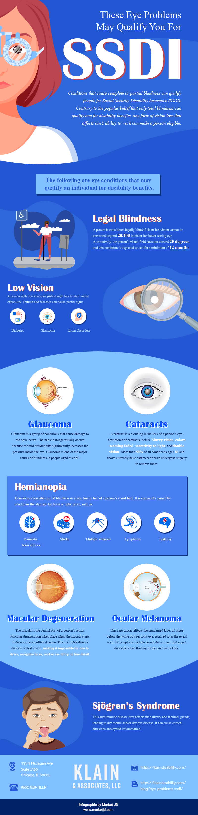 SSDI Qualifying Eye Problems Disability Attorney